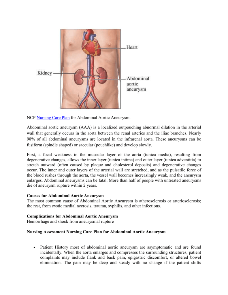 NCP Nursing Care Plan For Abdominal Aortic Aneurysm Abdominal