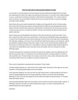 EXTRACTION POSTOPERATIVE INSTRUCTIONS