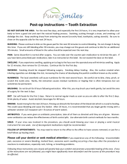 Post-op Instructions - Tooth Extraction