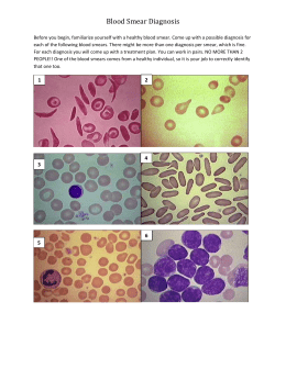 Smear Preparation and Simple Stain Objectives: Make bacterial