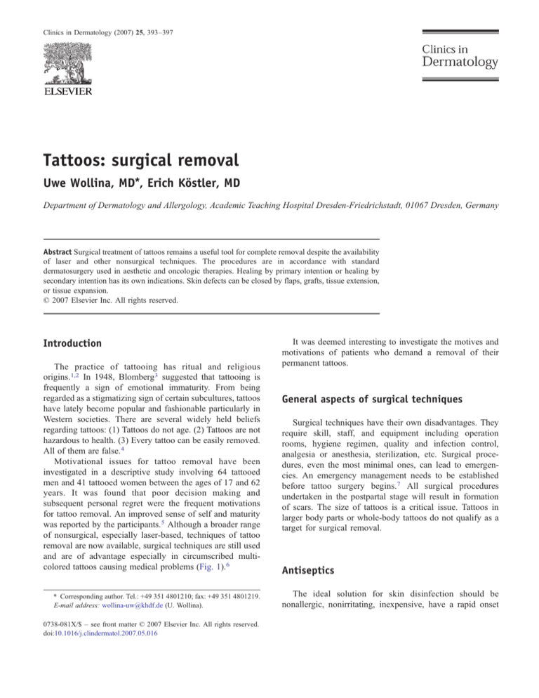 Tattoos: surgical removal