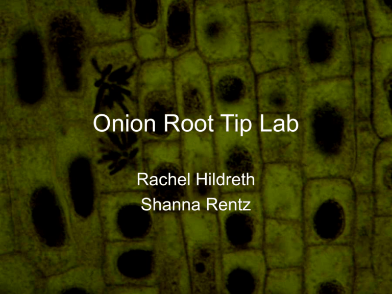 Onion Root Tip Lab Onion Root Tip Lab