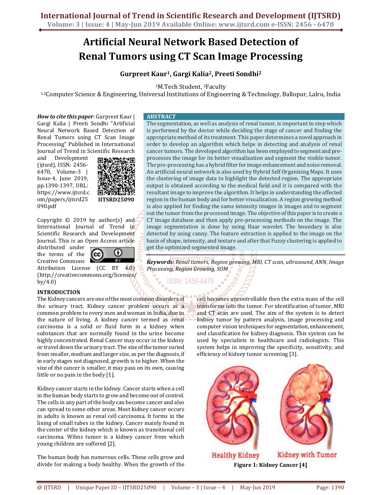 Artificial Neural Network Based Detection of Renal Tumors Using CT Scan ...